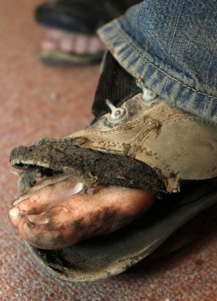 Odor-Eaters Rotten Sneaker Contest 2011 | Amusing Planet